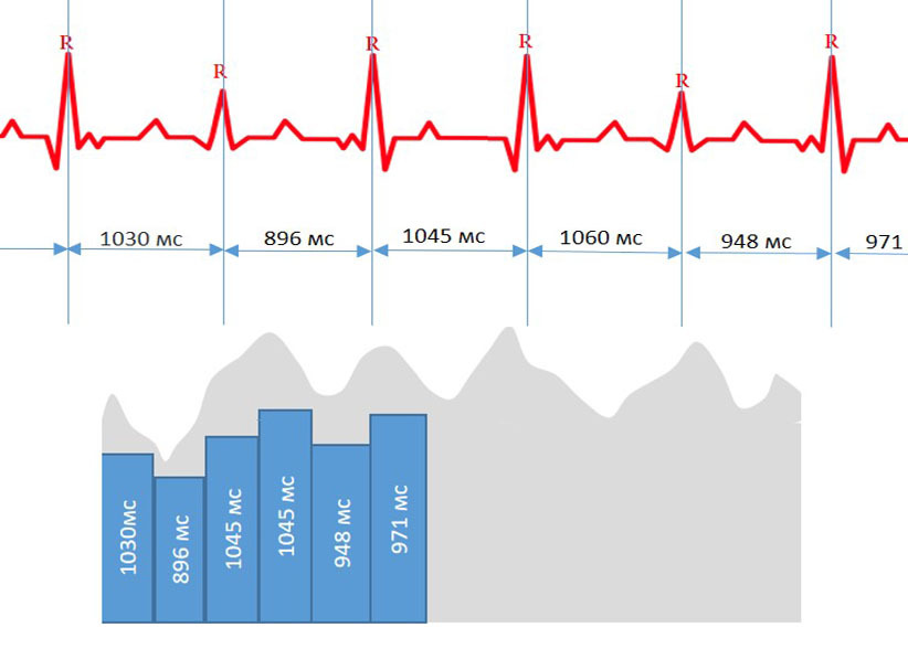 Jak měřit variabilitu srdeční frekvence? Heart Vision (EKG) vs. Hodinky ...